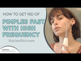 High Frequency Facial Wand & Acne Device | StackedSkincare